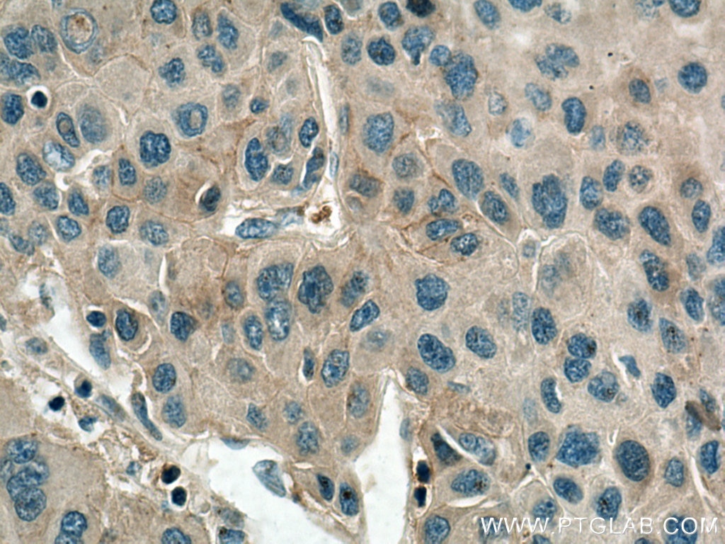CDKL5 Fusion Protein Ag3531 | Proteintech