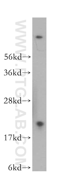 Centrin 2 Antibody 15877-1-AP | Proteintech