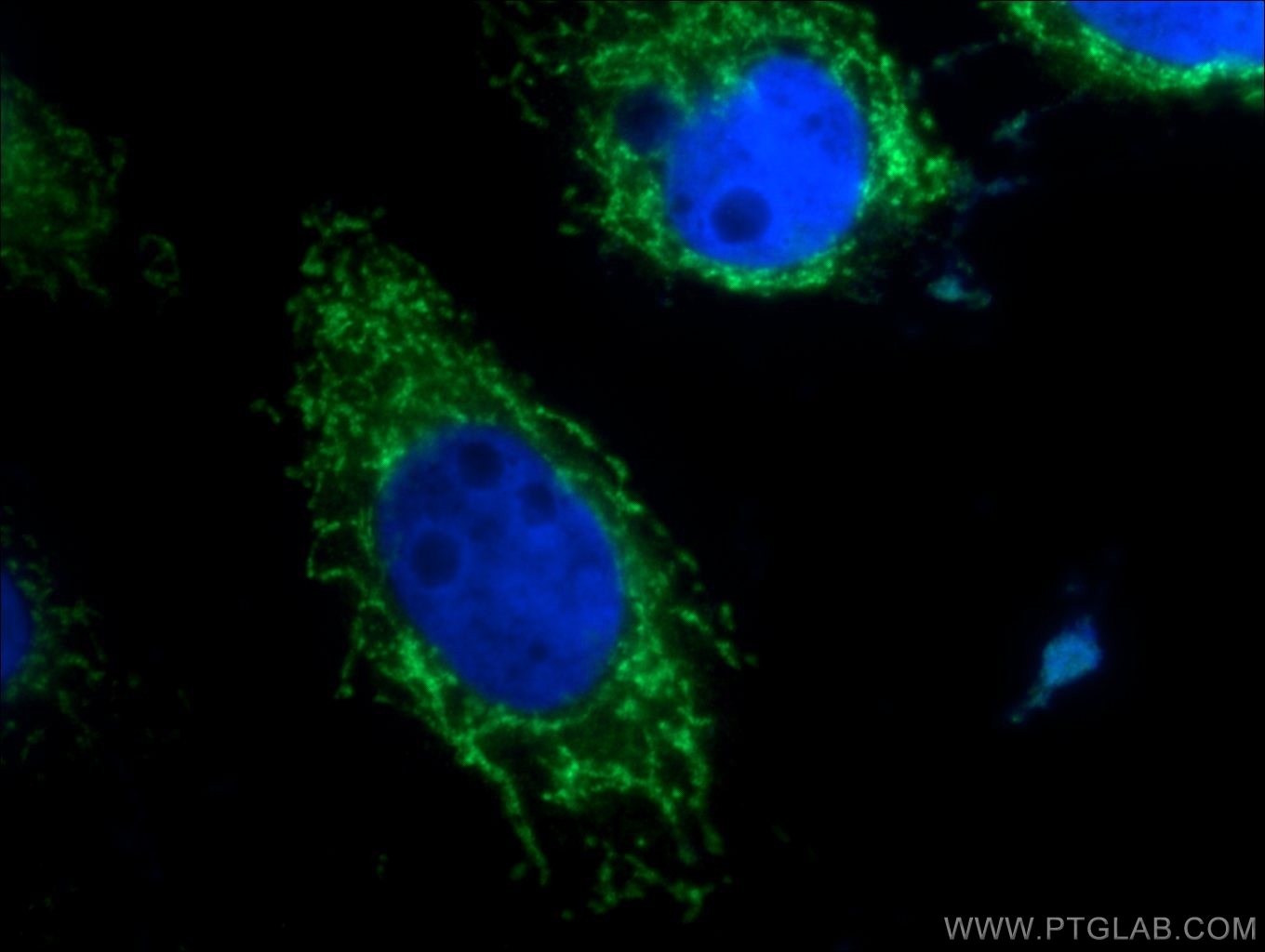 CHCHD10 Antibody 25671-1-AP | Proteintech
