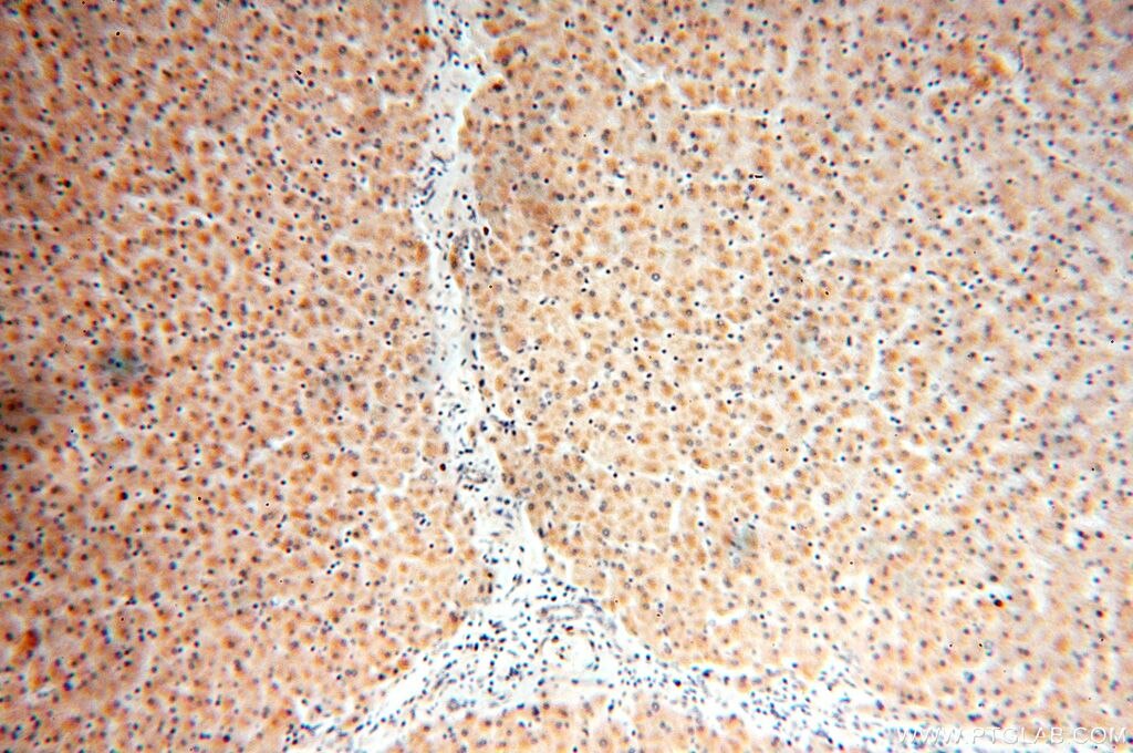 CHDH Antibody 17356-1-AP | Proteintech