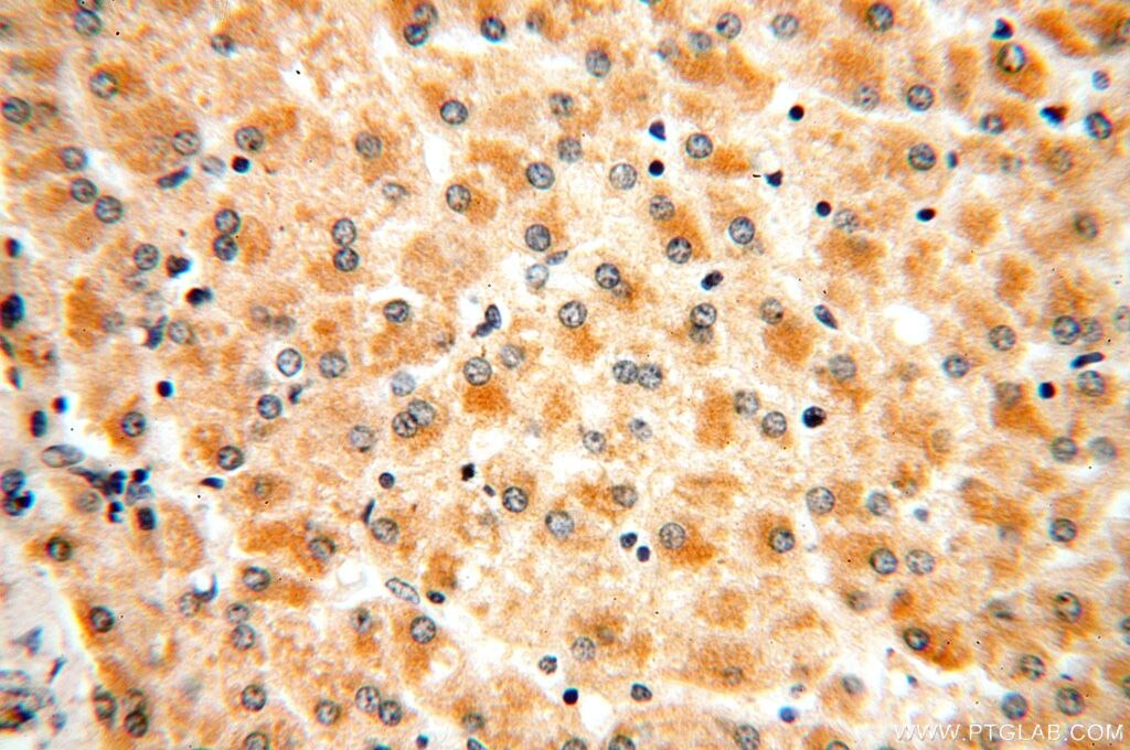 CHDH Fusion Protein Ag10883 | Proteintech