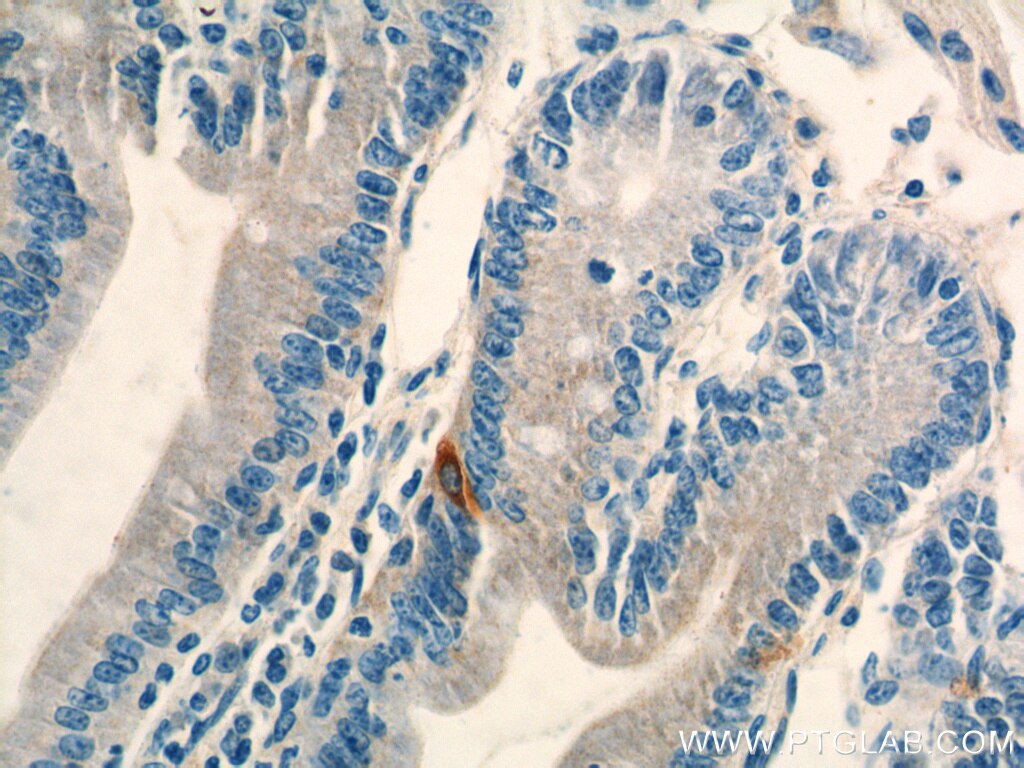 Chromogranin A Antibody 10529-1-AP | Proteintech