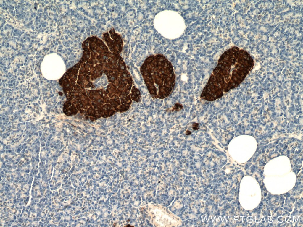 Chromogranin A Antibody 60135-1-Ig | Proteintech