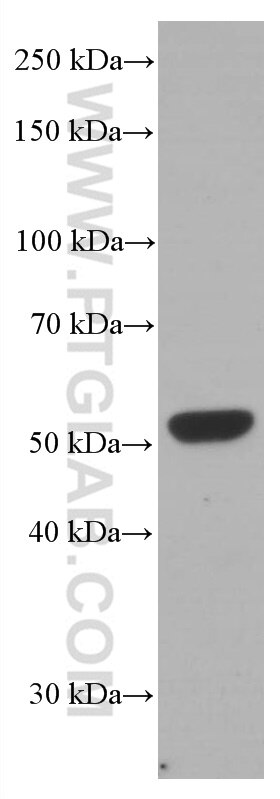 Chk1 antibody (60277-1-Ig) | Proteintech