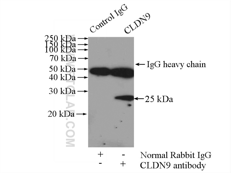 Claudin 9-specific antibody (16196-1-AP) | Proteintech