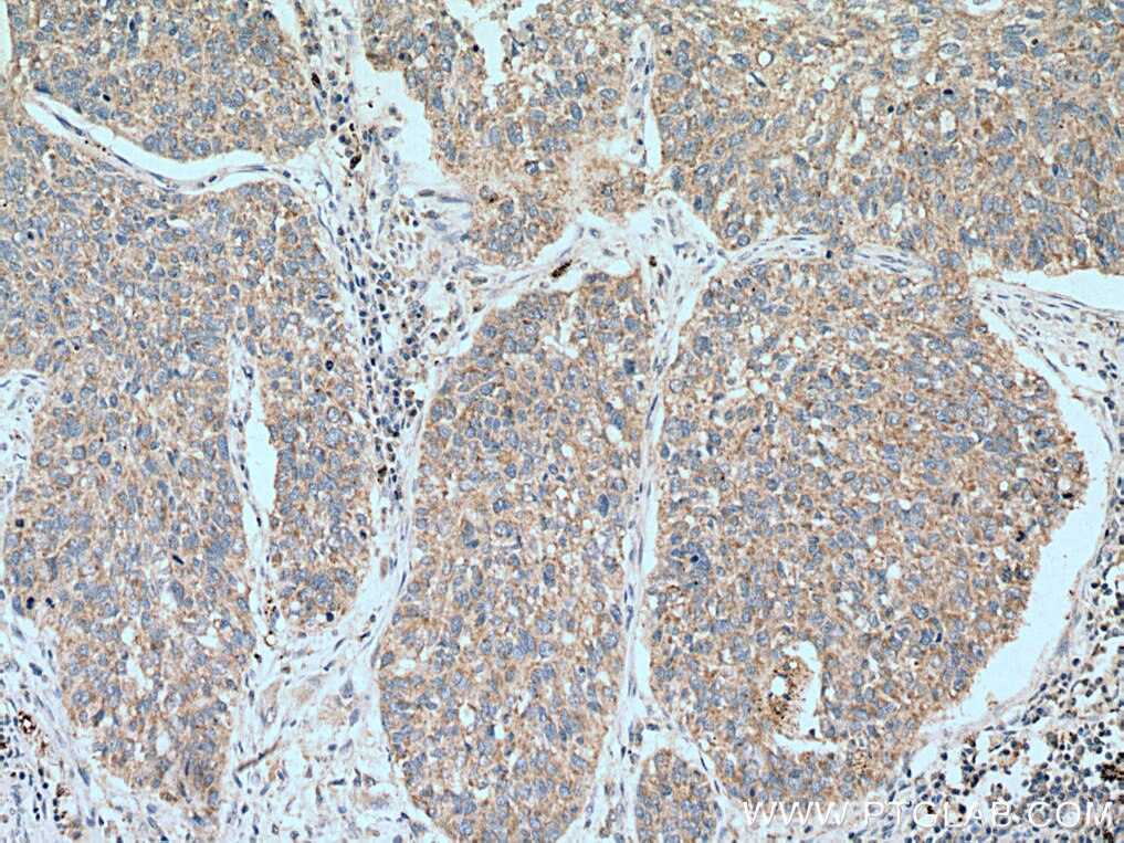 CLK2 Antibody 11092-1-AP | Proteintech