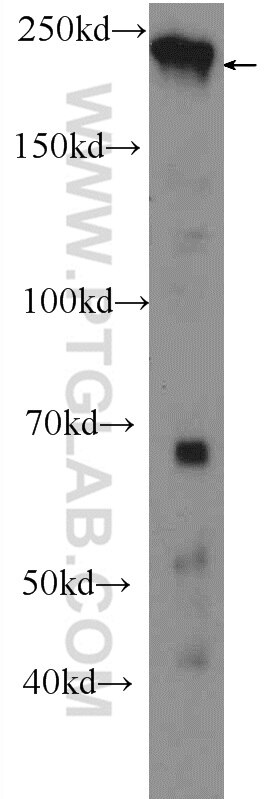 Claspin antibody (23206-1-AP) | Proteintech