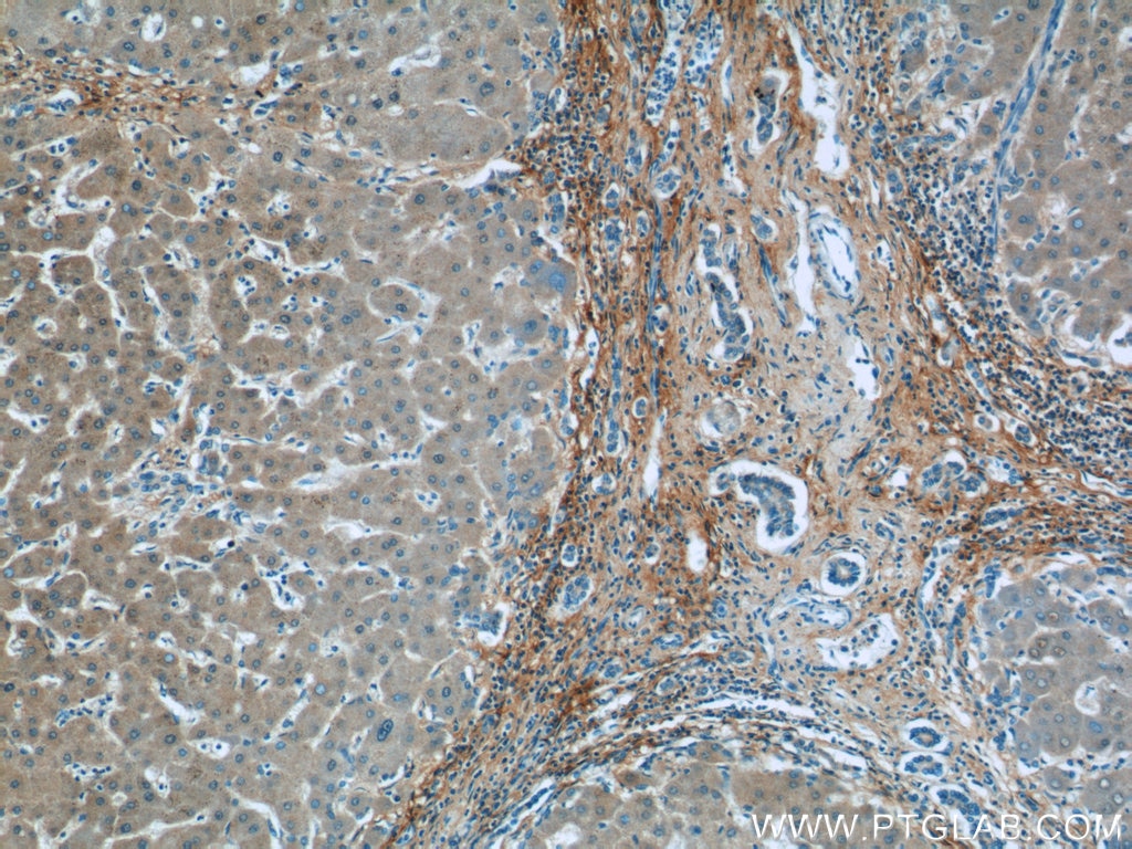 Collagen Type III (C-terminal) antibody (13548-1-AP) | Proteintech