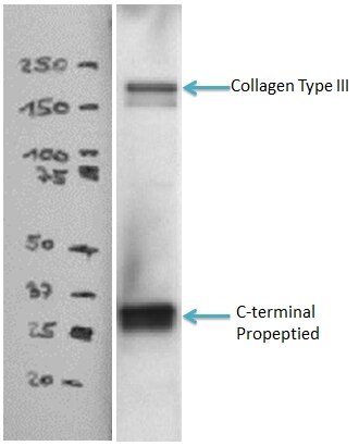 Collagen Type III (C-terminal) Antibody 13548-1-AP | Proteintech