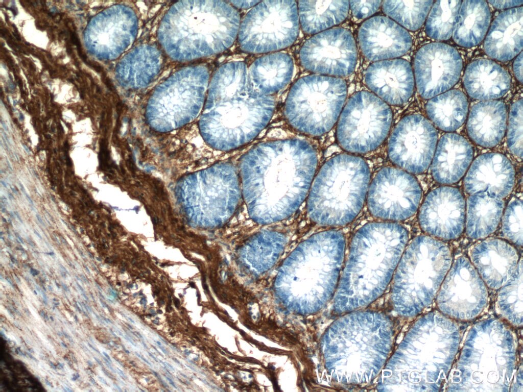 Collagen Type I antibody (14695-1-AP) | Proteintech