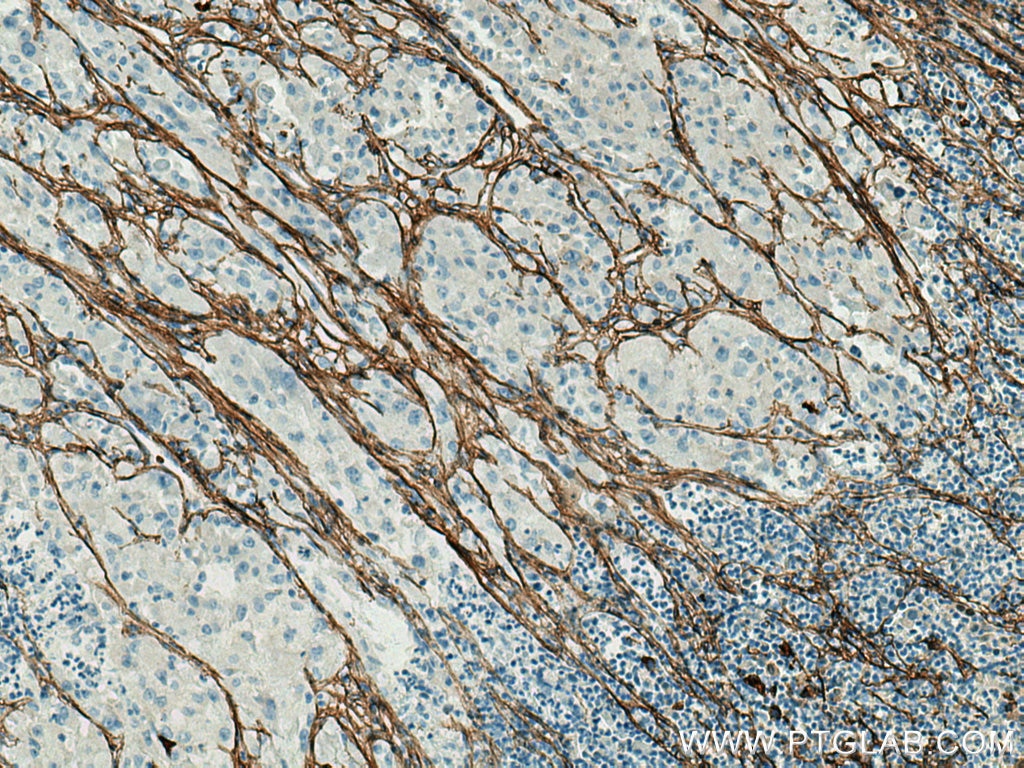 Collagen Type III (N-terminal) antibody (80009-1-RR) | Proteintech