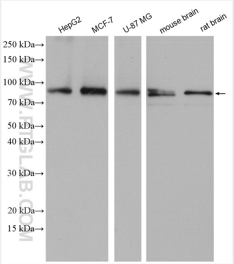 CPT1A Antibody 15184-1-AP | Proteintech