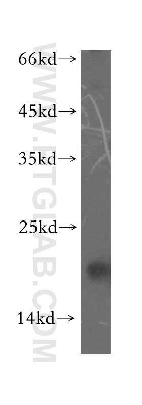 CRCP Antibody 14348-1-AP | Proteintech