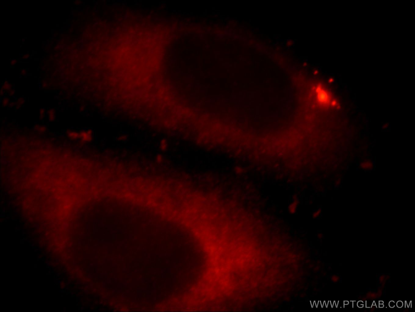 CRYBB3 Antibody 21009-1-AP | Proteintech