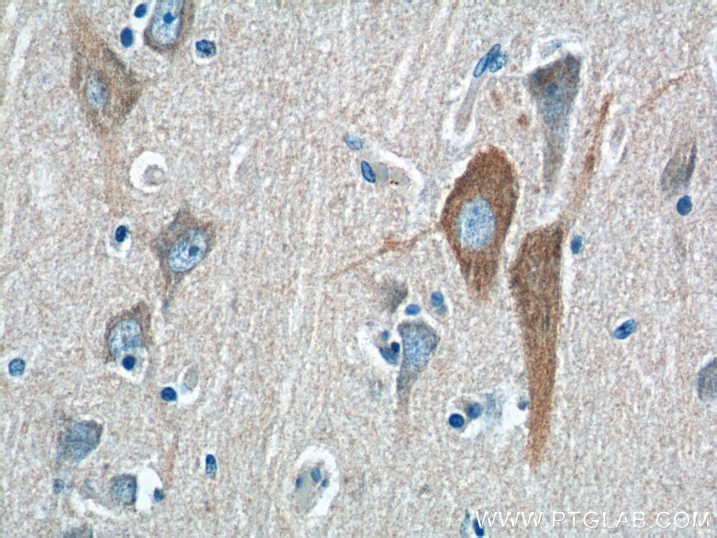 CSF1R antibody (25949-1-AP) | Proteintech