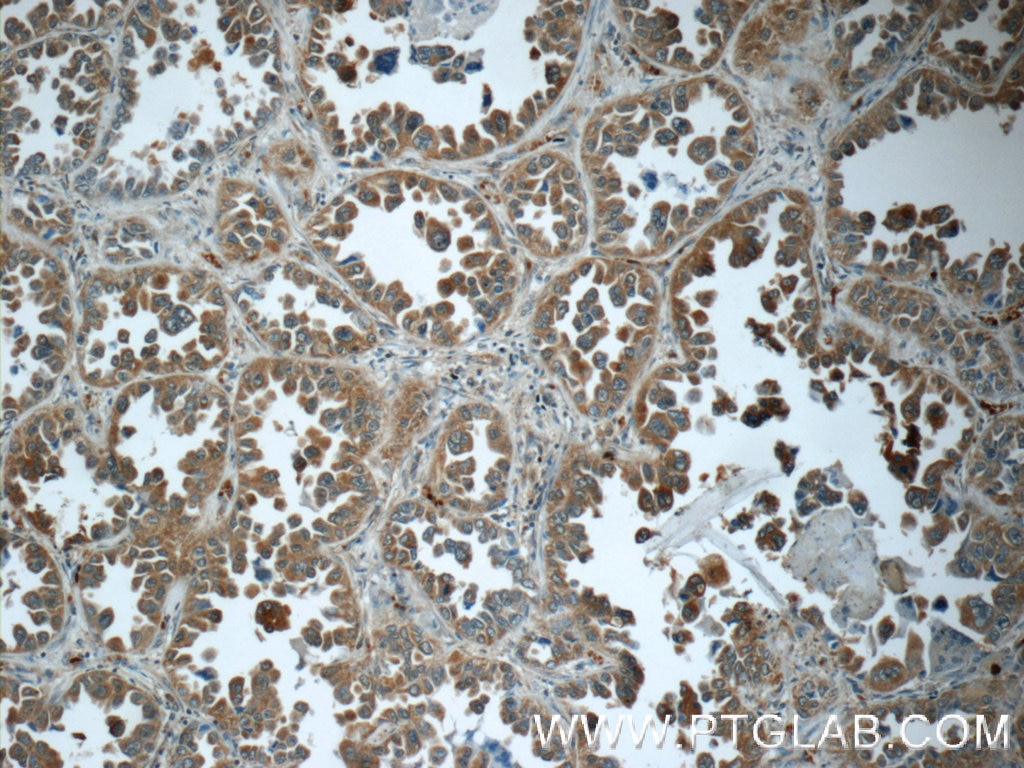Cathepsin K antibody (11239-1-AP) | Proteintech