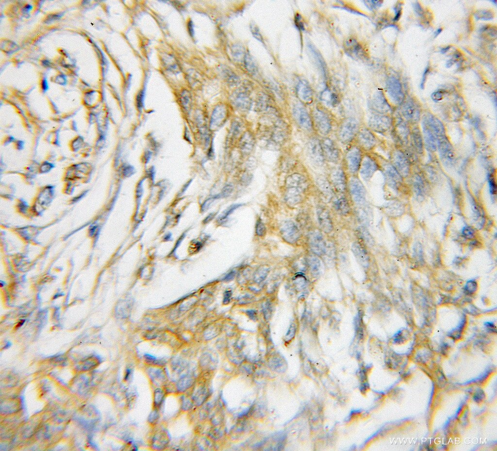 Cortactin Antibody 11381-1-AP | Proteintech