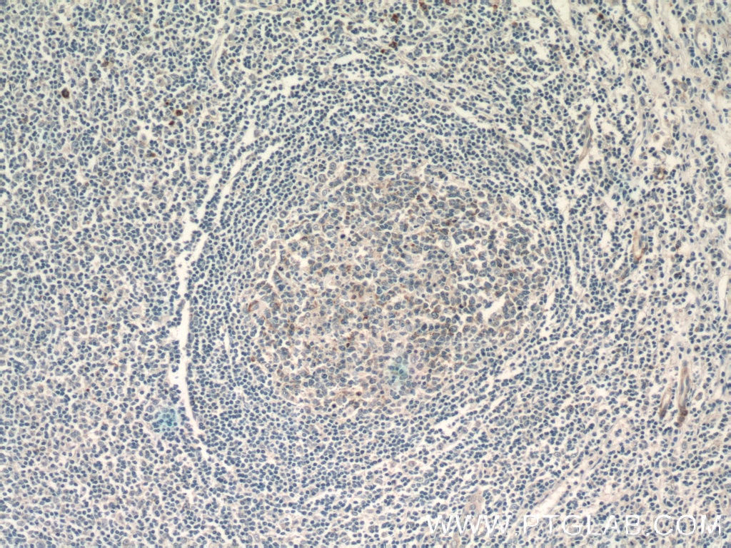 CXCL13/BCA1 antibody (10927-1-AP) | Proteintech