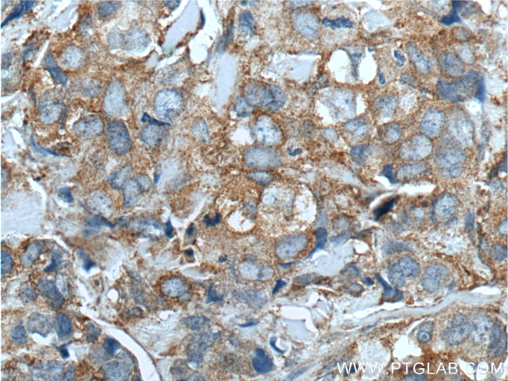 CXCL14 antibody (10468-1-AP) | Proteintech