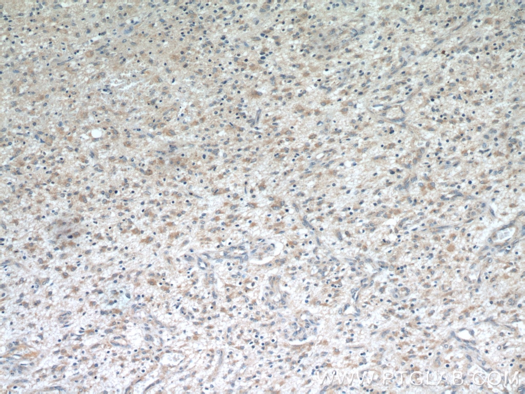 CYFIP1/2 Antibody 16011-1-AP | Proteintech