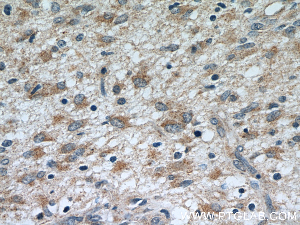 CYFIP1/2 Antibody 16011-1-AP | Proteintech