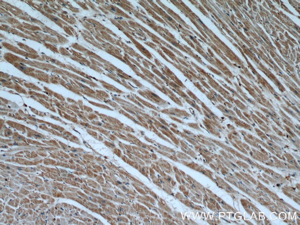 Cytoglobin antibody (13317-1-AP) | Proteintech
