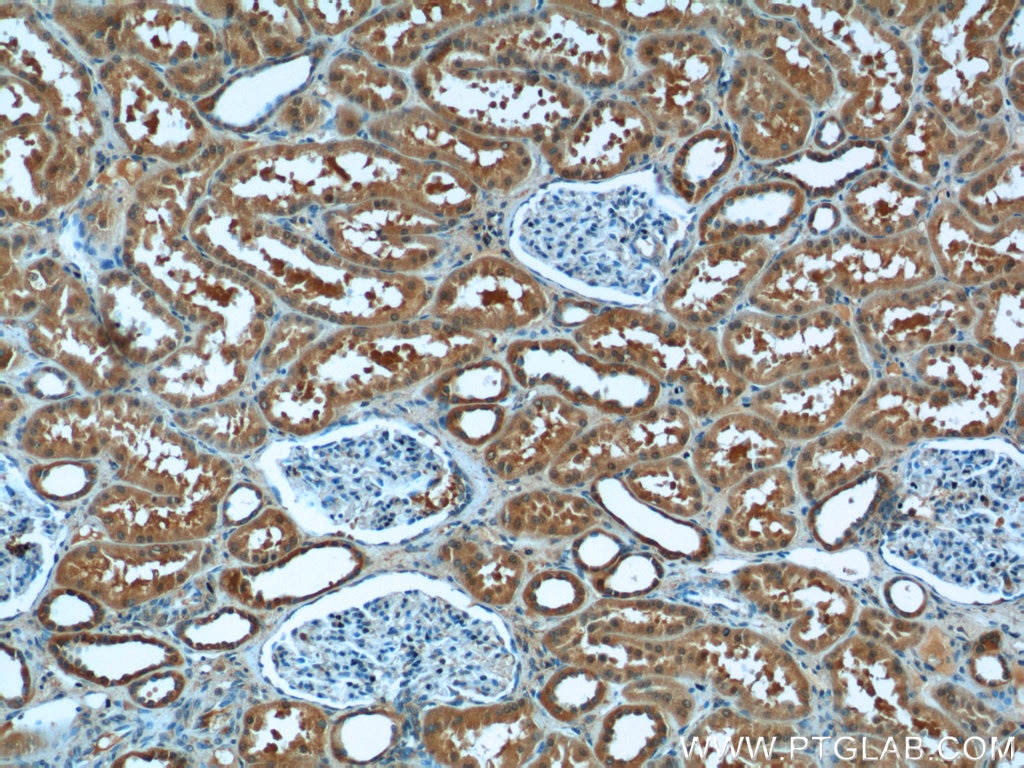 CYP11B2 antibody (20968-1-AP) | Proteintech