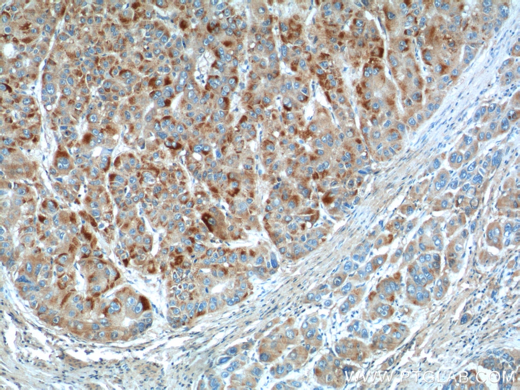 CYP11B2 antibody (20968-1-AP) | Proteintech