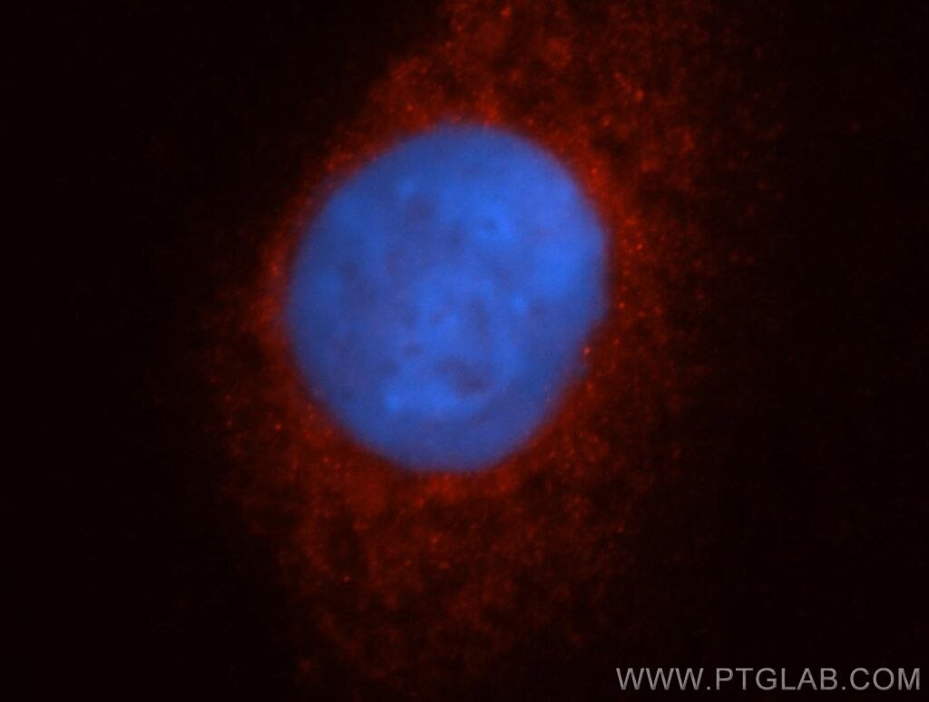 Cytochrome P450 Family 17 Subfamily A Member 1 Antibodies ...