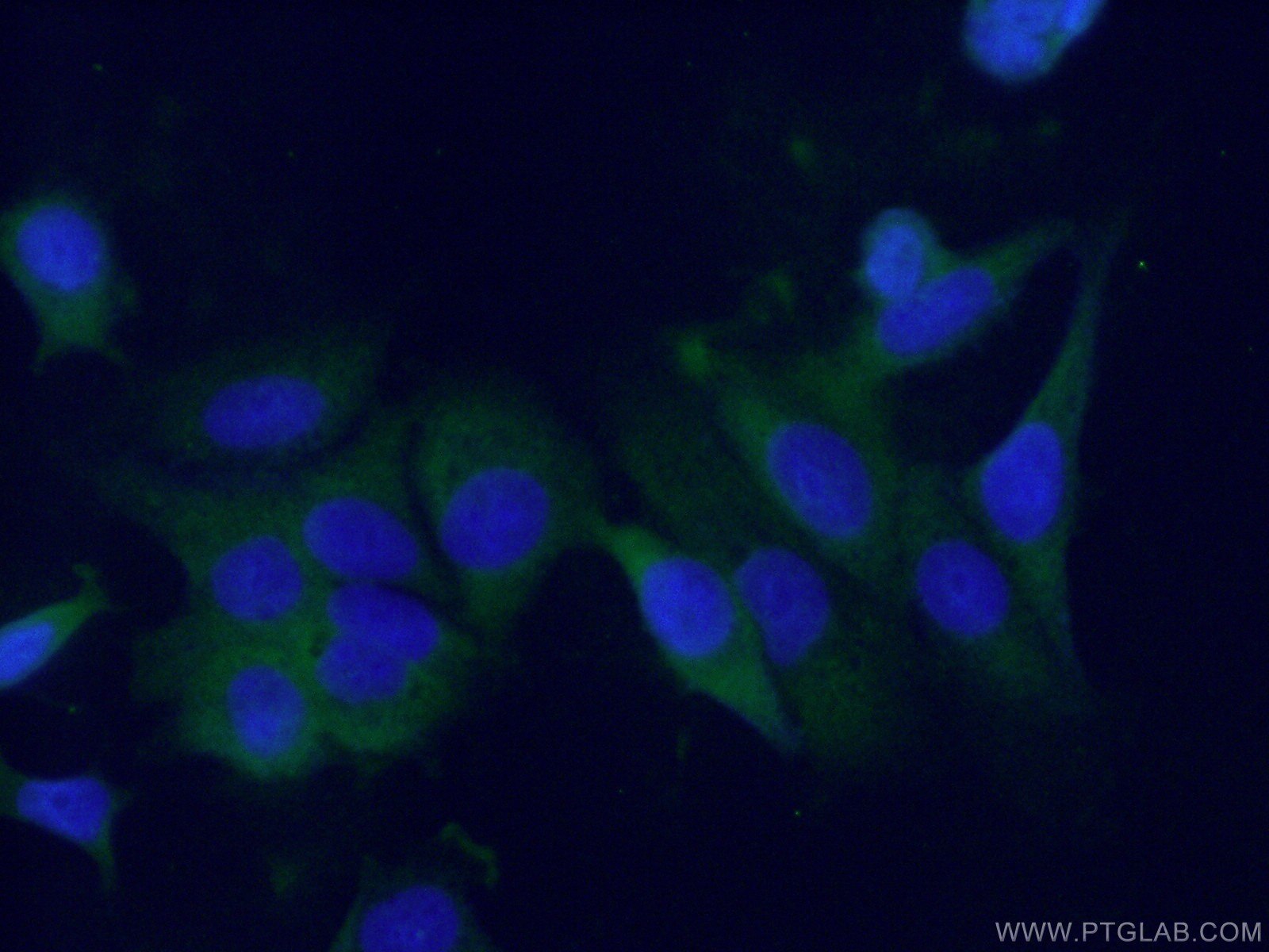 CYR61/CCN1 Antibody 26689-1-AP | Proteintech