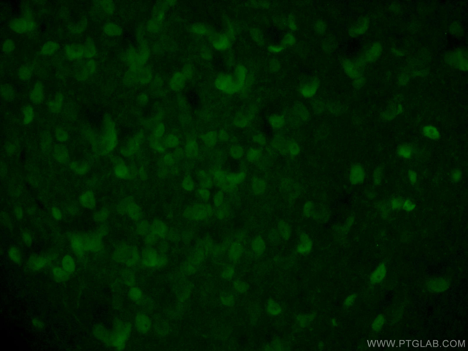 Calbindin 1 Antibodies | AntibodyResource.com