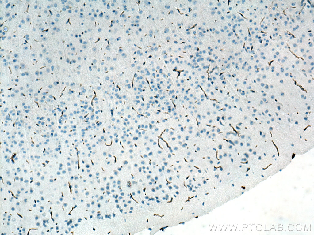 CD31 antibody (28083-1-AP) | Proteintech