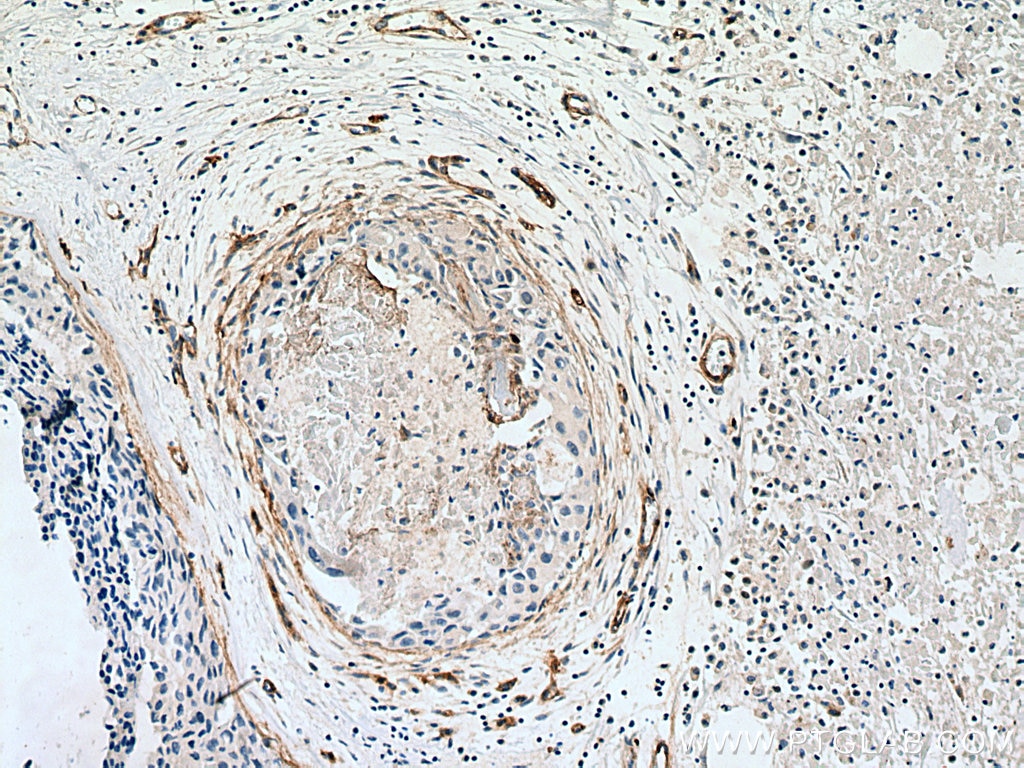 Collagen Type IV Antibody 55131-1-AP | Proteintech