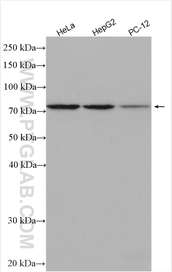 DDX3 antibody (11115-1-AP) | Proteintech