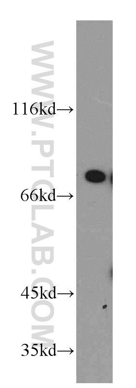 DDX3 Antibody 11115-1-AP | Proteintech