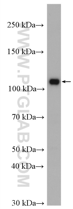 DIS3 Antibody 14689-1-AP | Proteintech