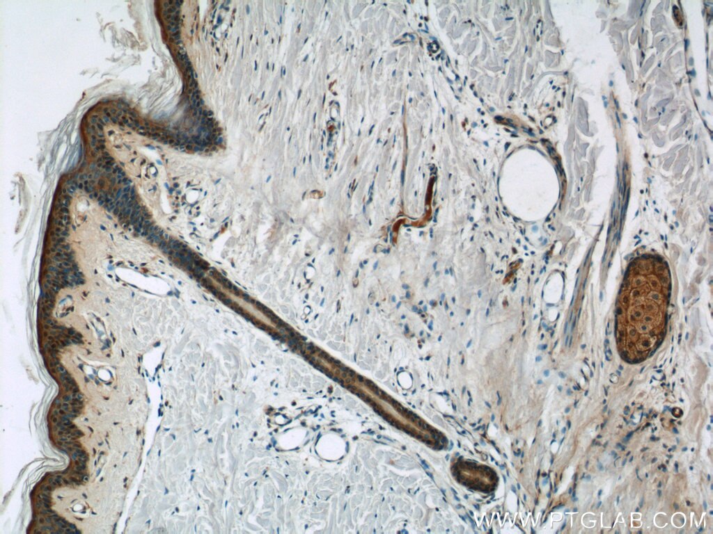 DMKN Antibody 16252-1-AP | Proteintech