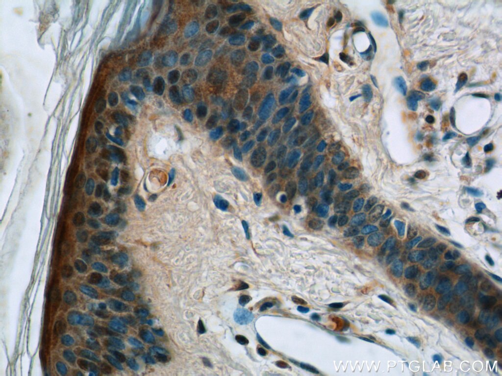 DMKN Antibody 16252-1-AP | Proteintech