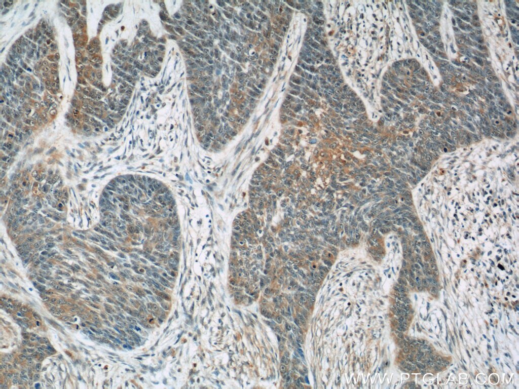 DMKN Antibody 16252-1-AP | Proteintech