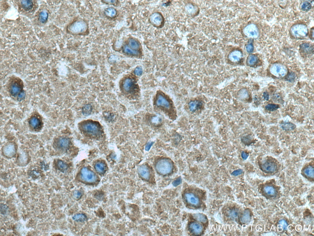 Dynamin 1 antibody (18205-1-AP) | Proteintech