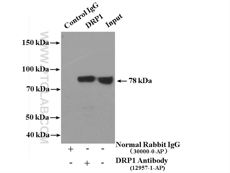 Dynamin 1 Like Antibodies | AntibodyResource.com
