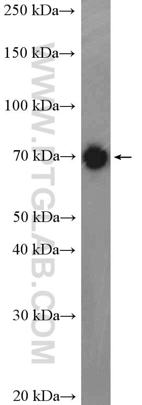 Dynamin 1 Like Antibodies | AntibodyResource.com