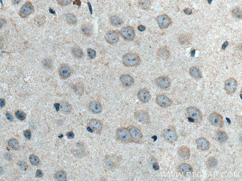 DRD1 antibody (17934-1-AP) | Proteintech
