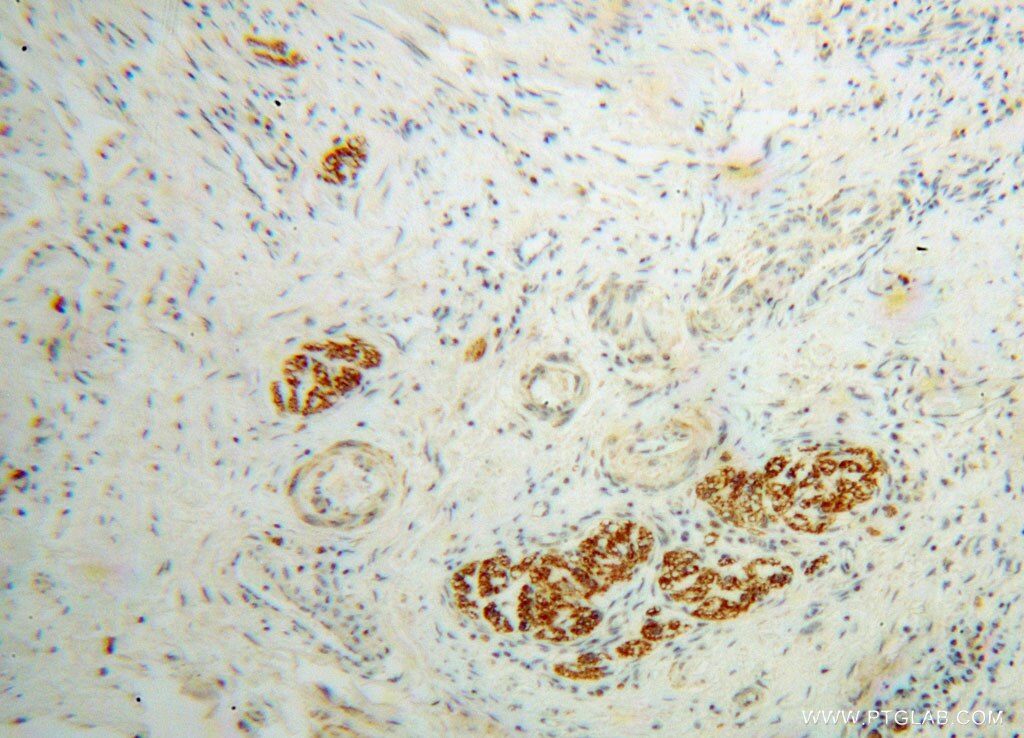 DRG2 Antibody 14743-1-AP | Proteintech