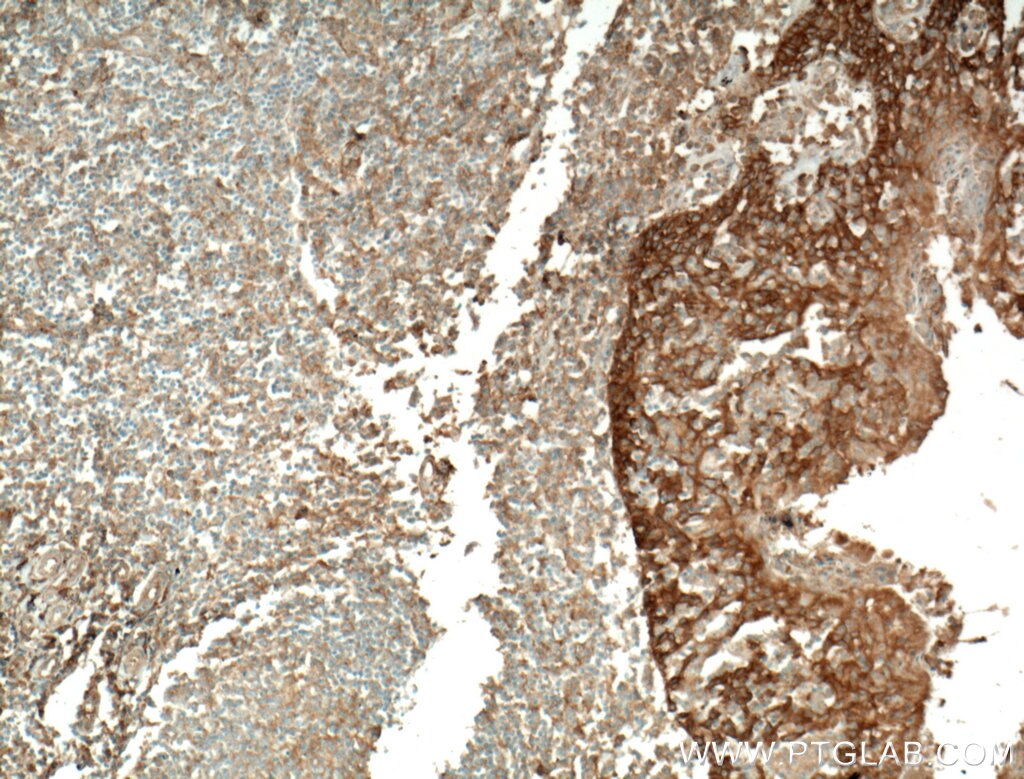 Egfr Antibody 66455 1 Ig Proteintech