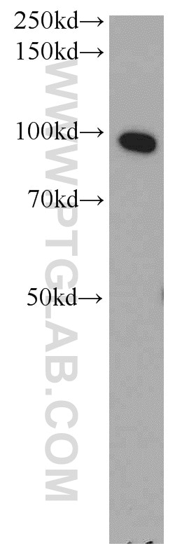 ELAC2 antibody (10071-1-AP) | Proteintech