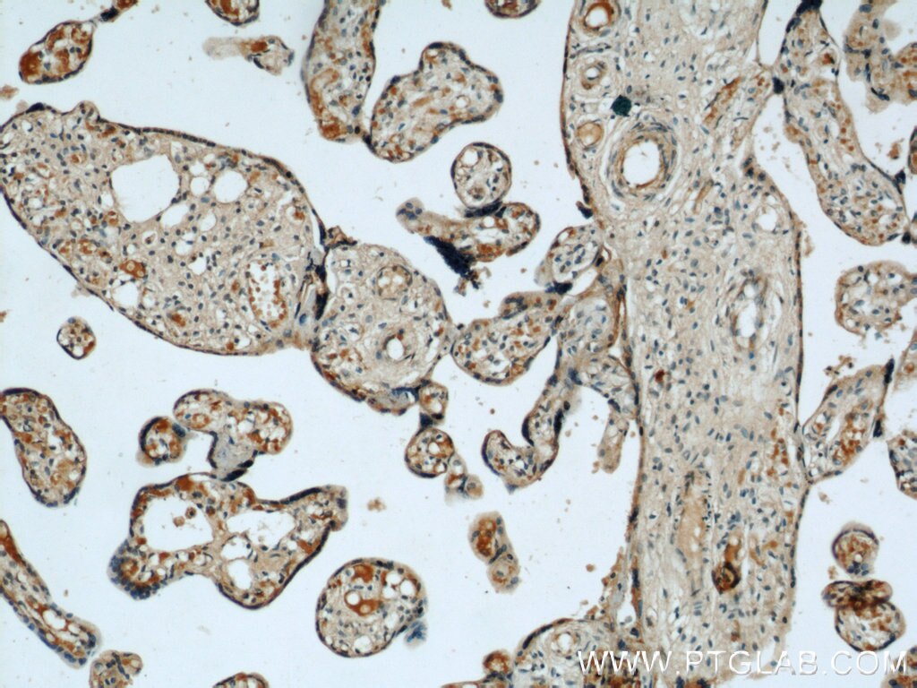 Endoglin/CD105 Antibody 10862-1-AP | Proteintech
