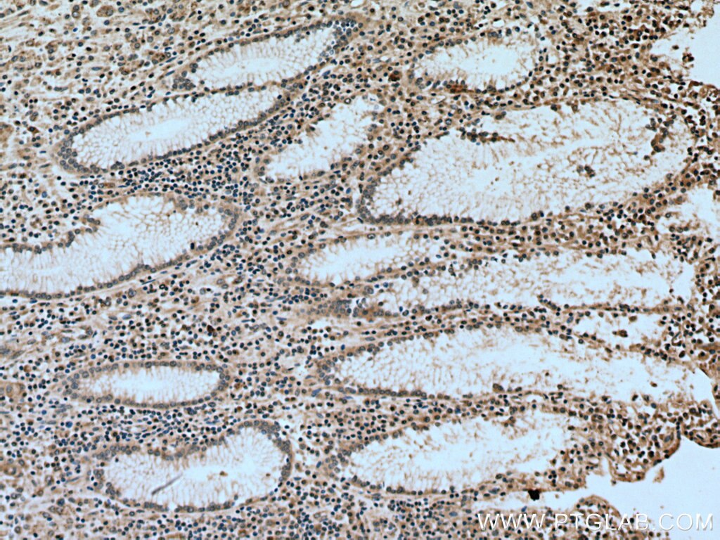 NSE/ENO2-specific antibody (55235-1-AP) | Proteintech
