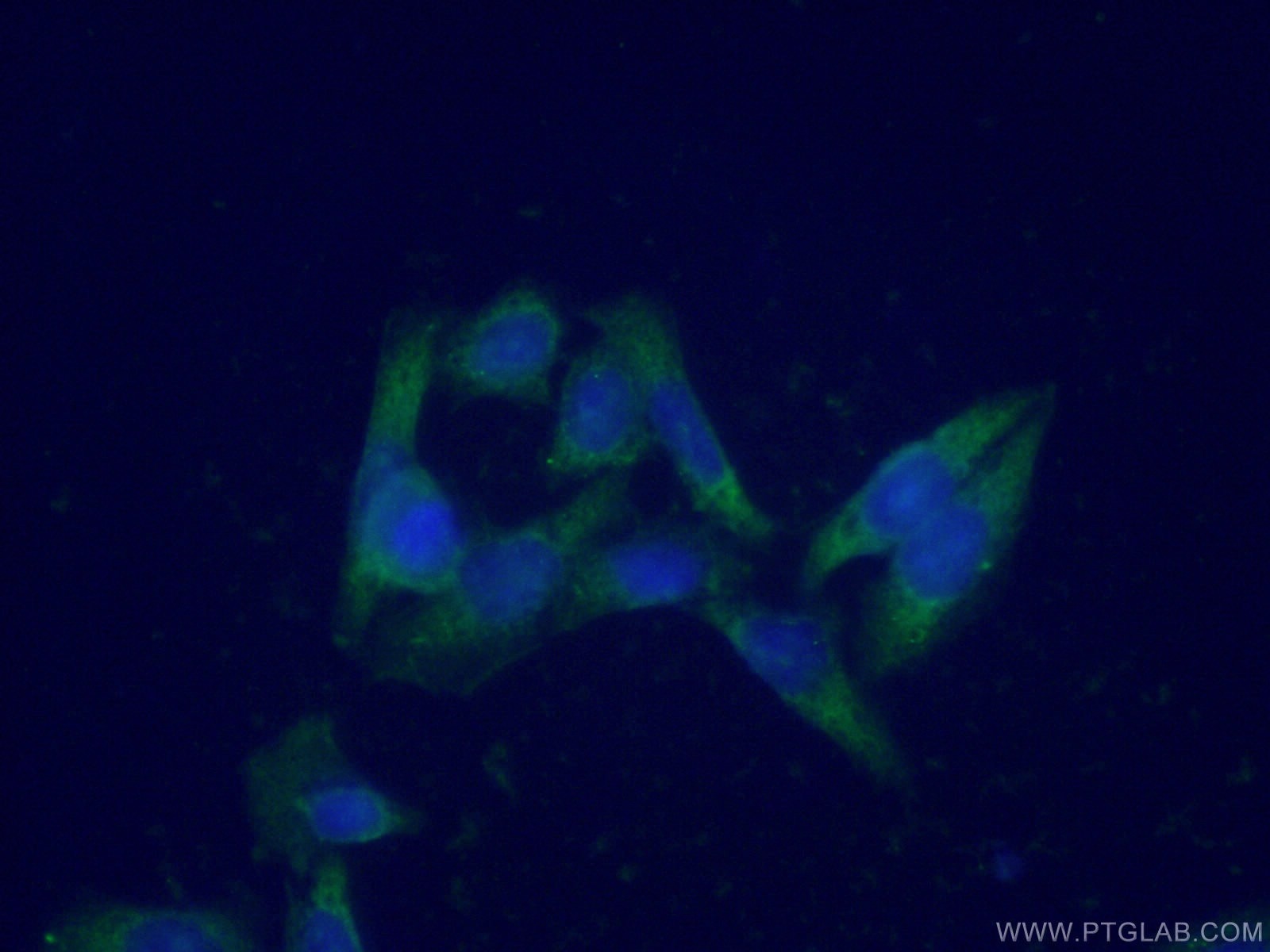 Enolase 3 Antibodies | AntibodyResource.com