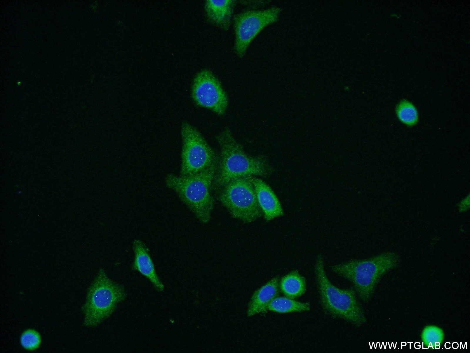 ERGIC1 antibody (16108-1-AP) | Proteintech